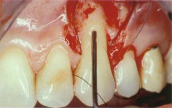 ALL DENTE MVZ - Leistungen - Paradontologie